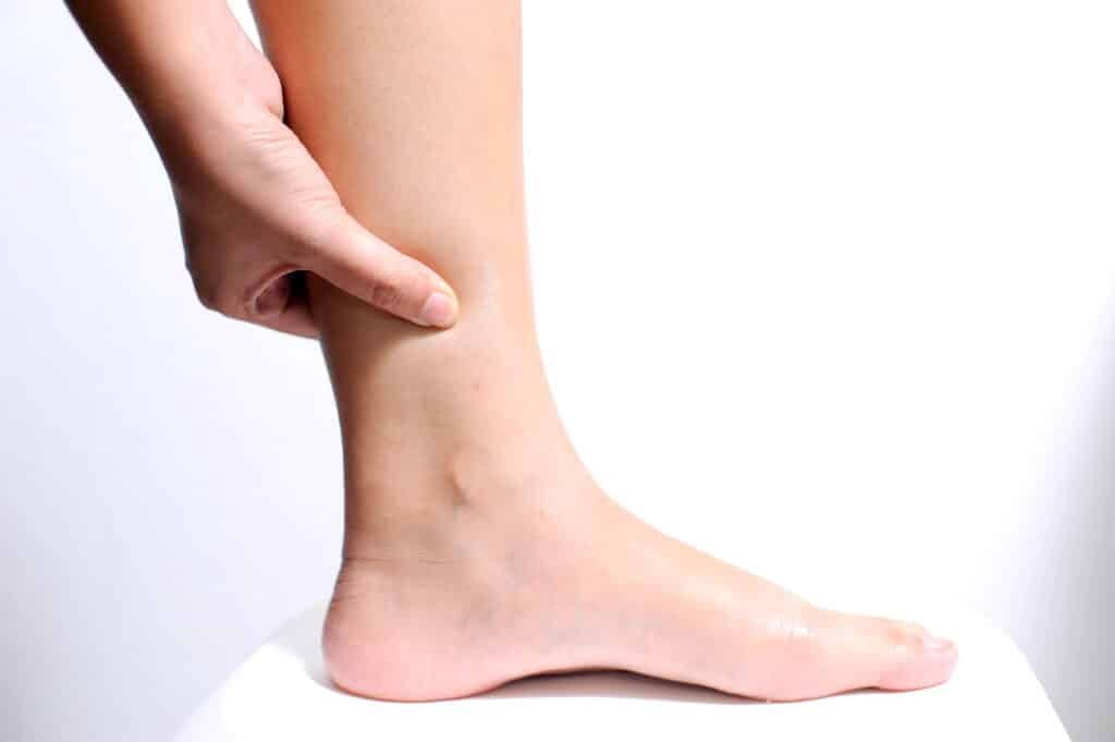 Fat Injections Could Treat Common Cause of Foot Pain - WorldHealth.net